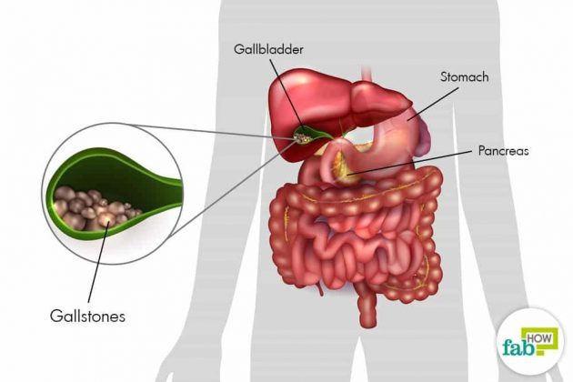 Gallbladder diagram