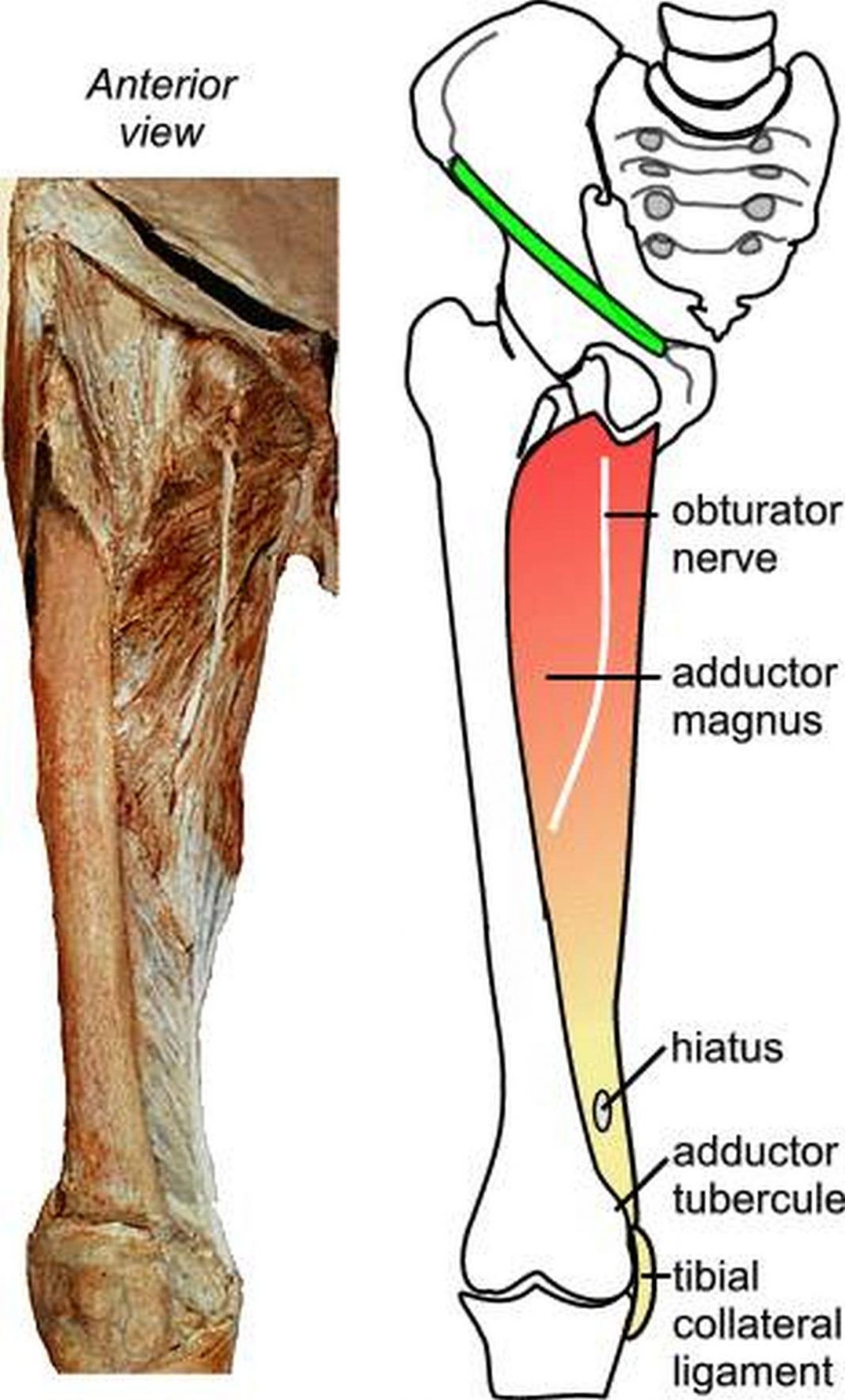 Pictures Of Adductor Magnus Tendons