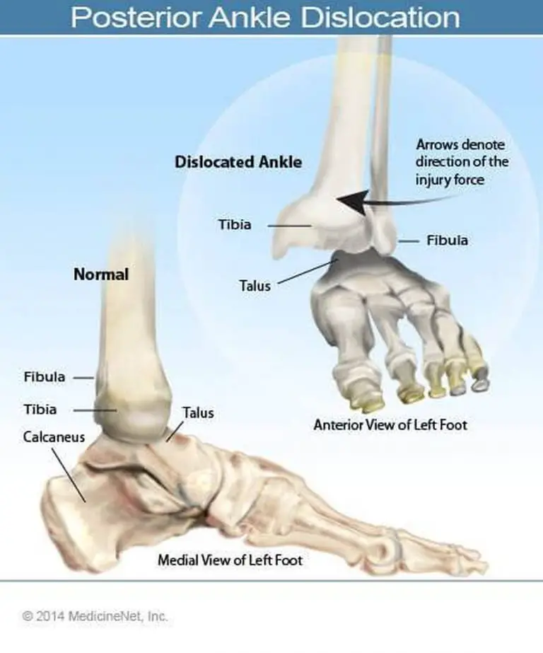 Pictures Of Ankle