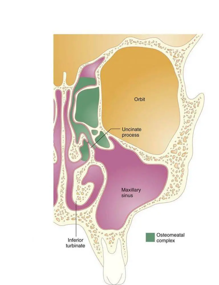 Pictures Of Anterior Ethmoid Sinuses