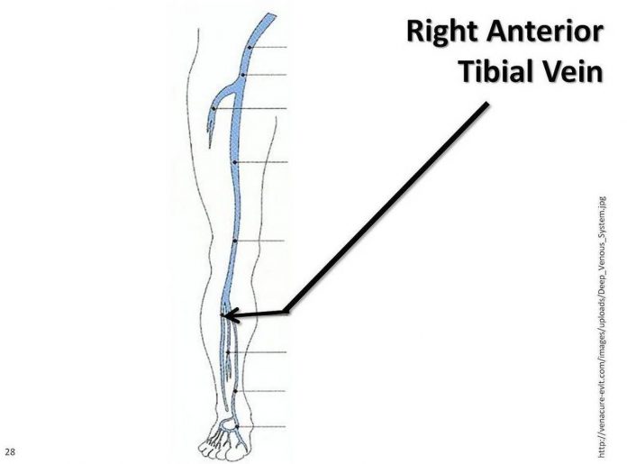 Pictures Of Anterior Tibial Vein