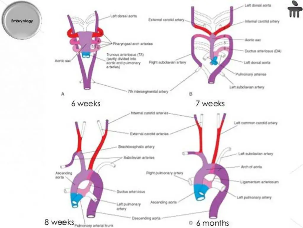 Pictures Of Aortic Arch