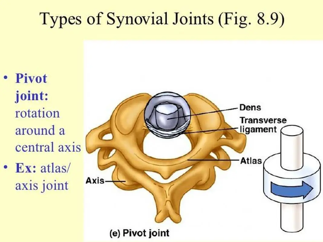 Pictures Of Atlas Axis Joint
