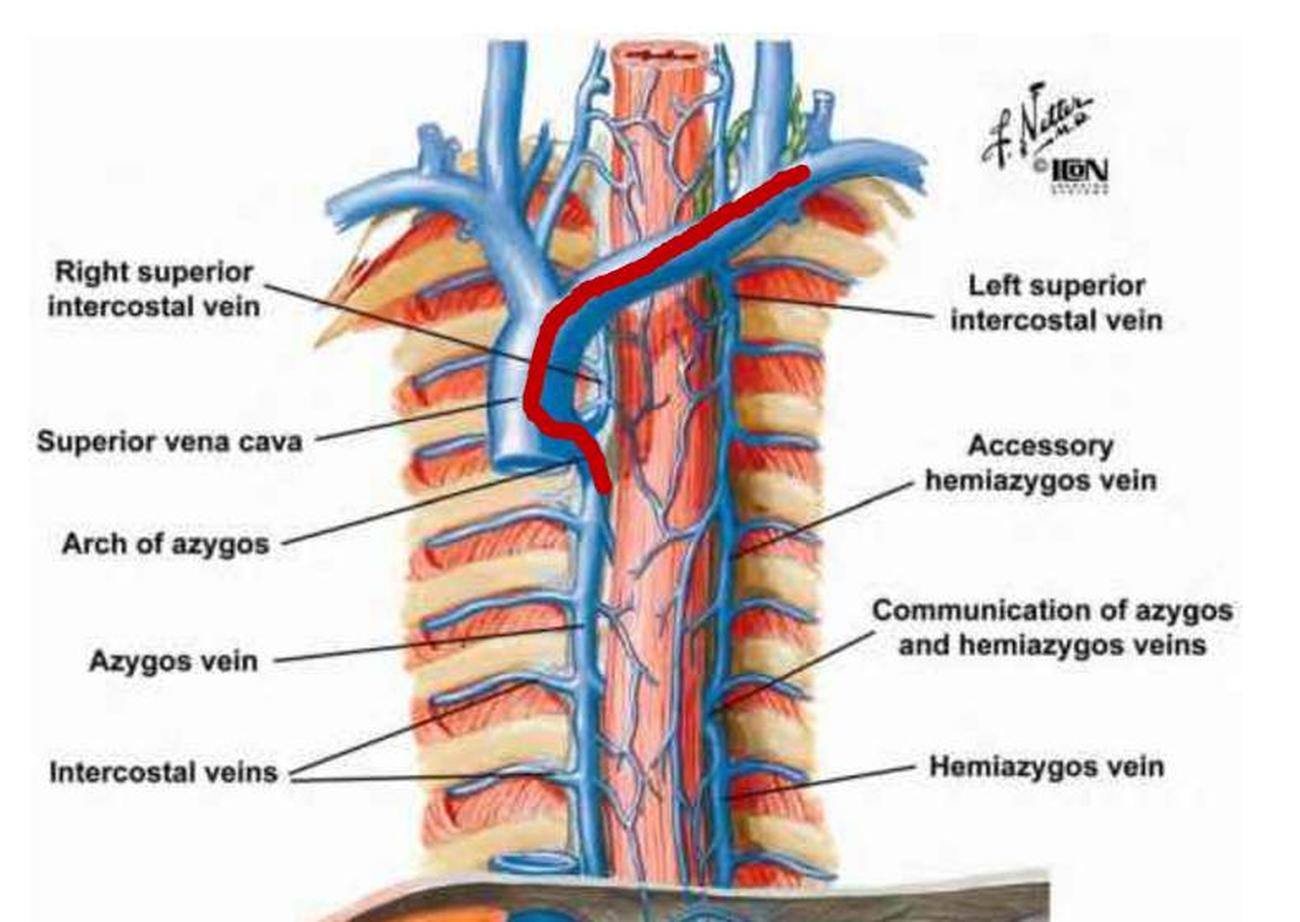 Pictures Of Azygos Vein Pictures Of Azygos Vein