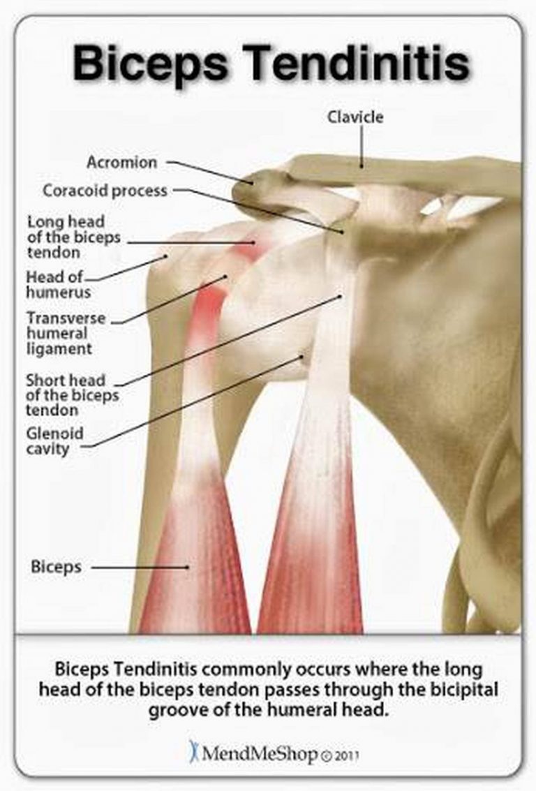 Pictures Of Biceps Brachii Tendons Pictures Of Biceps Brachii Tendons