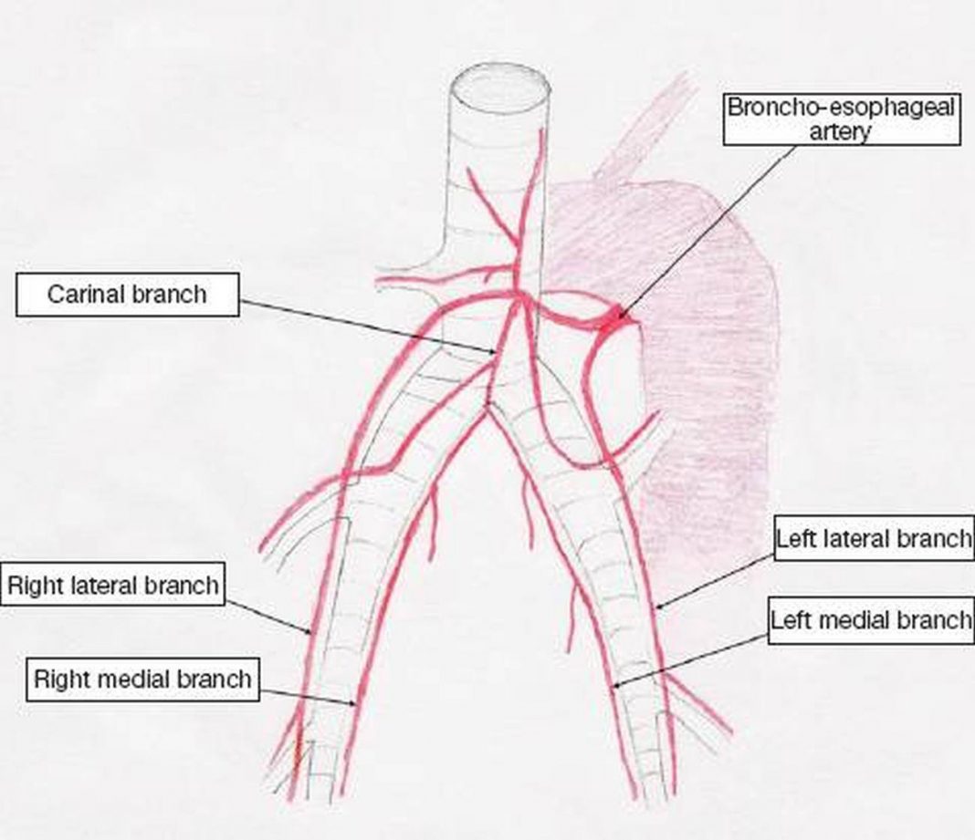 Pictures Of Bronchial Artery