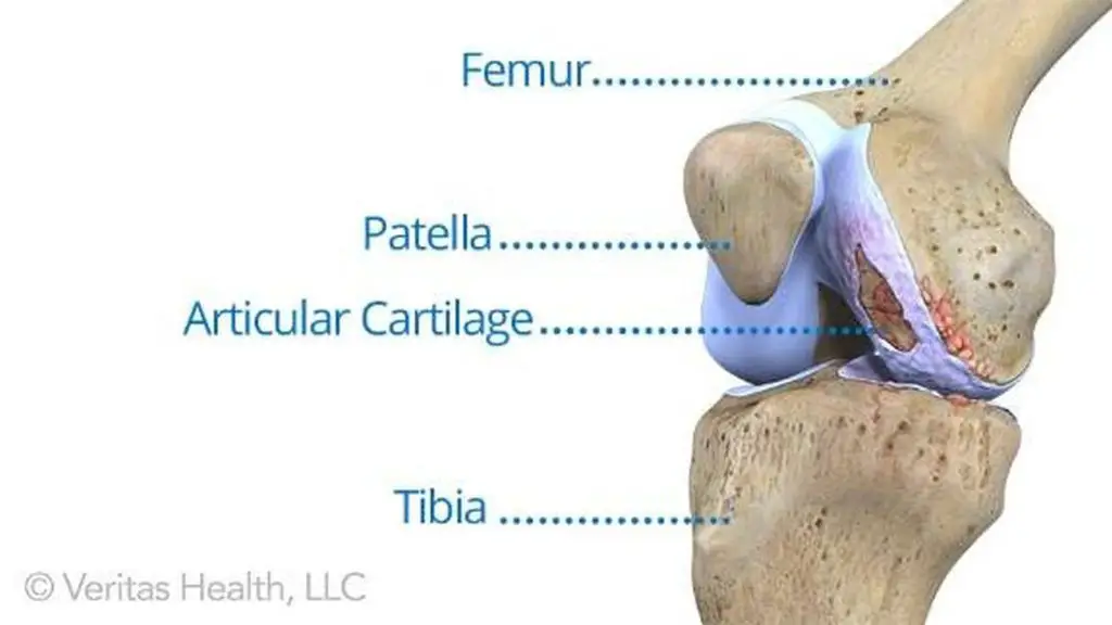 Pictures Of Cartilage