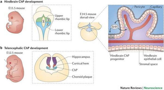 Pictures Of Choroid Plexus