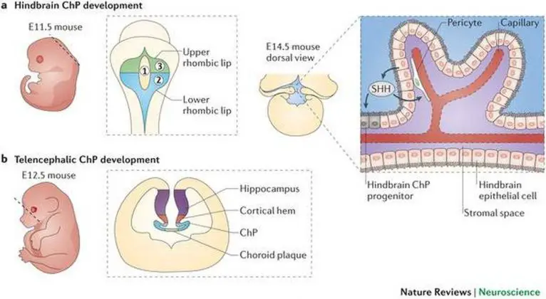 Pictures Of Choroid Plexus