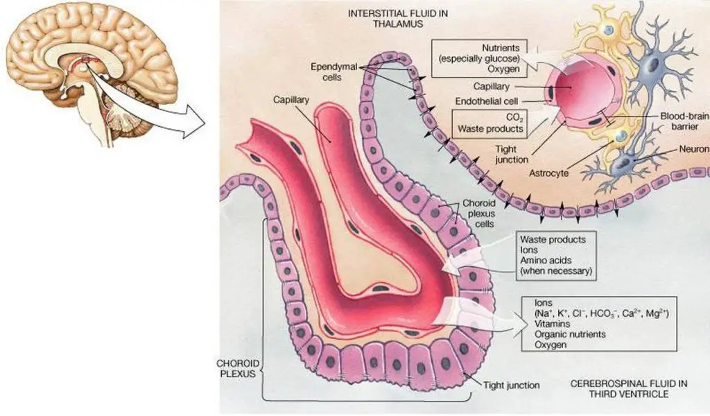 Pictures Of Choroid Plexus