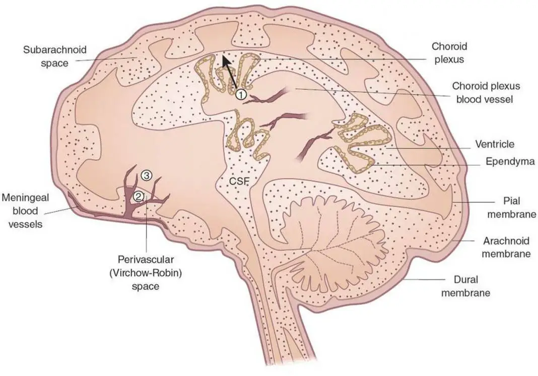 Pictures Of Choroid Plexus