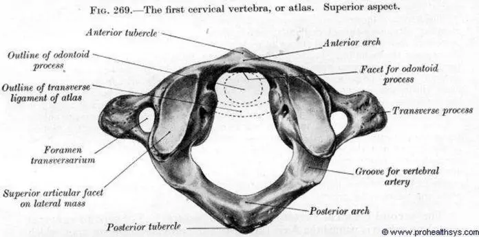 Pictures Of Anterior Arch