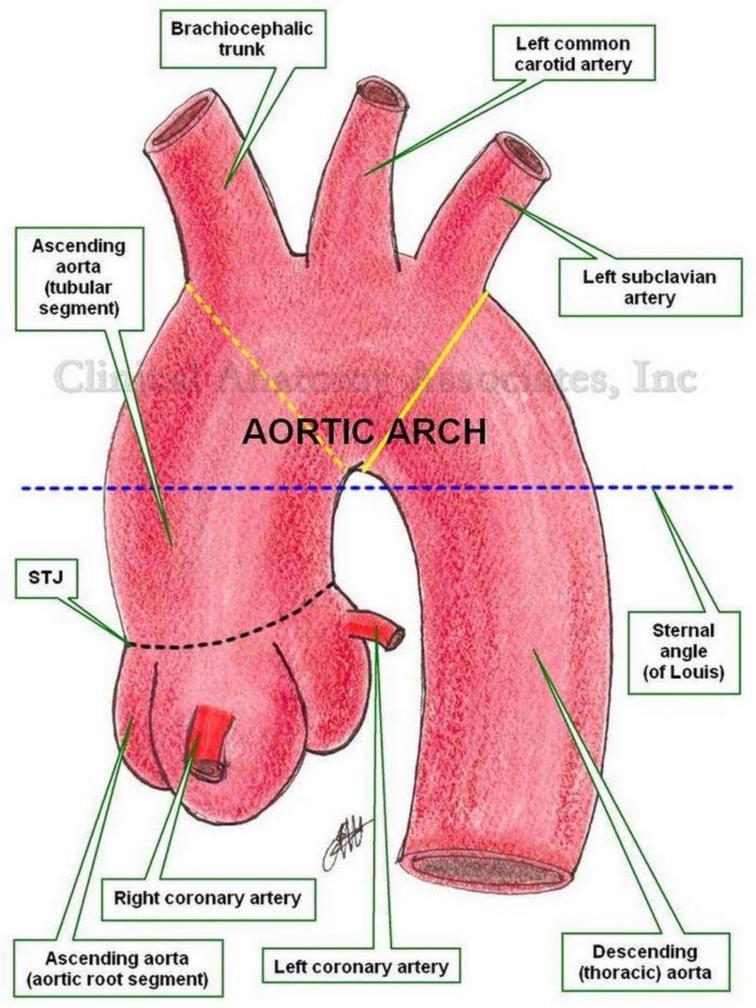 Pictures Of Ascending Aorta