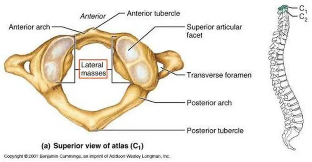 Pictures Of Atlas Vertebra