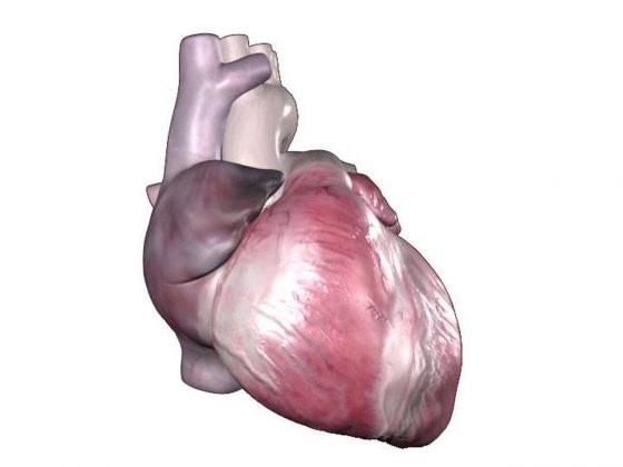 Pictures Of Atrial Appendage (auricle)
