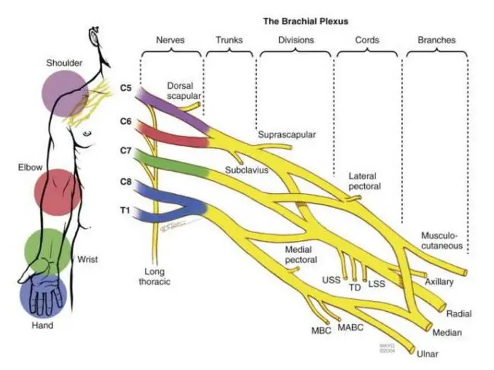 Pictures Of Brachial Plexus