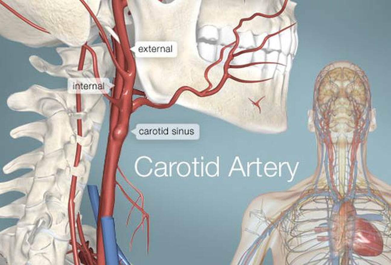 Pictures Of Carotid Arteries Pictures Of Carotid Arteries
