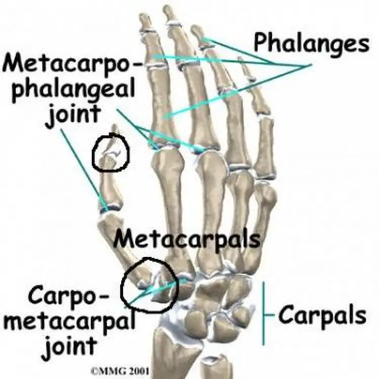Pictures Of Carpometacarpal Joints