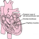 Pictures Of Chordae Tendineae | Healthiack