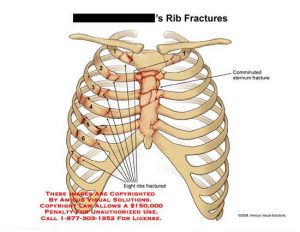 Sternum diagram