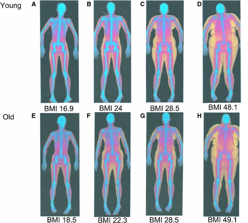 Body Fat Percentage Scanner Body Fat Percentage Body Fat Percentage Scanner Body Fat Percentage
